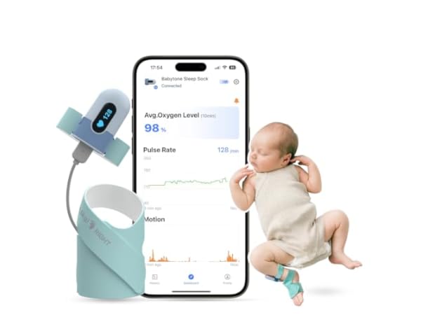 The 8 Best Babytone Baby Monitors of 2024 - FindThisBest